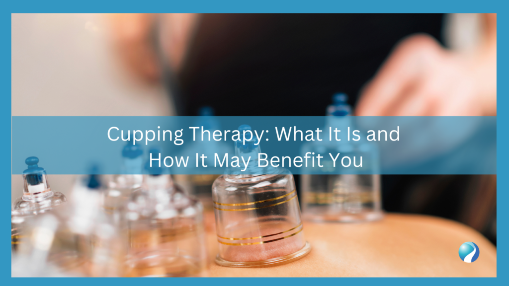 Cupping Therapy: What It Is and How It May Benefit You – Mississauga ...